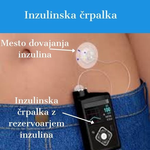 Sladkorna bolezen – diabetes tipa 1 – diabetesdr.si